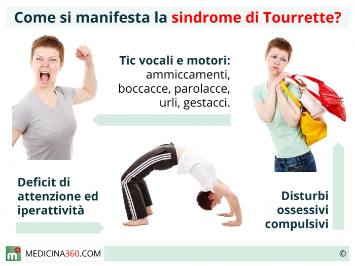 Sindrome di Tourette: sintomi, cause e cure del disturbo
